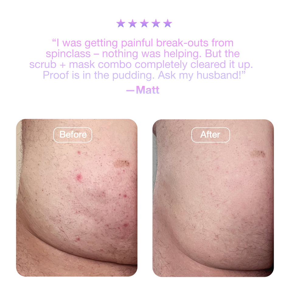 Buttface Skincare