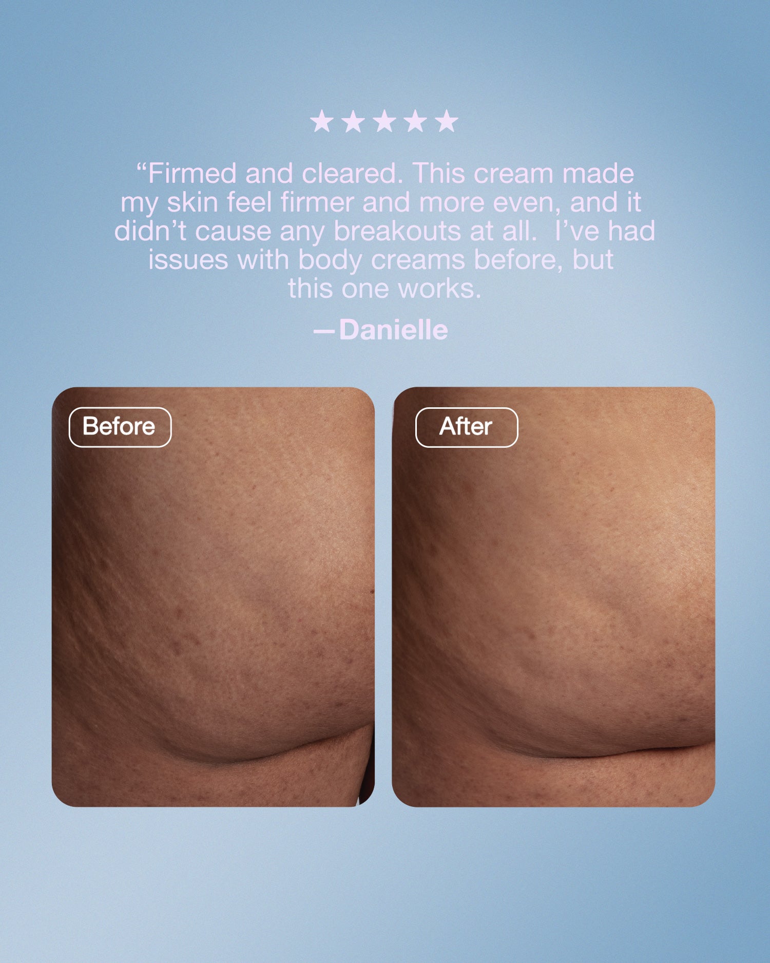 The BBL Firming Cream - Buttface