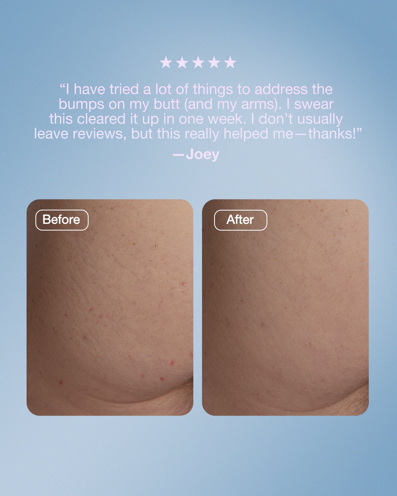 The Butt Facial™ Duo - Buttface